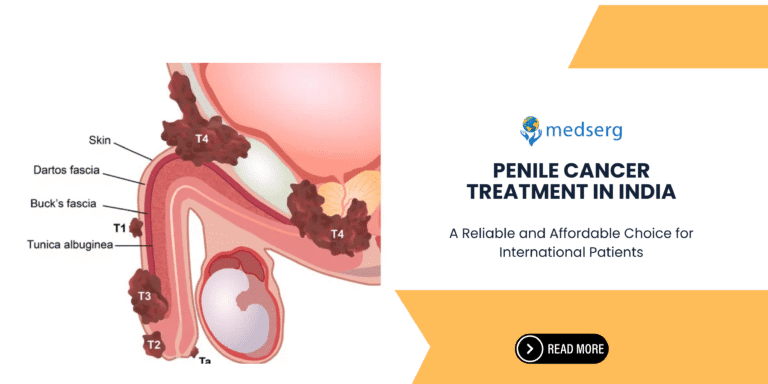 Penile Cancer Treatment in India from 3800 USD
